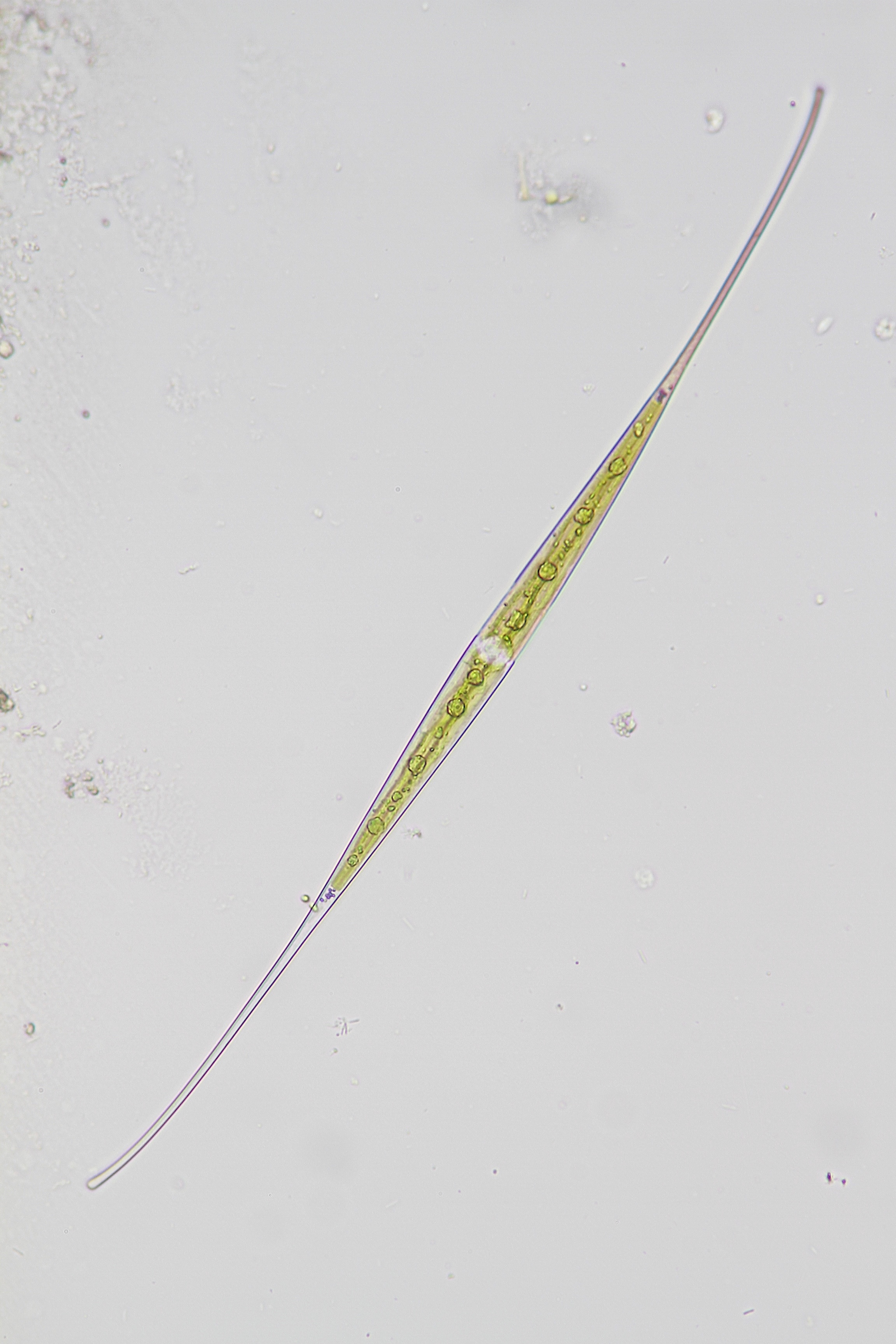 Closterium kuetzingii - Desmid of the Month: September 2024