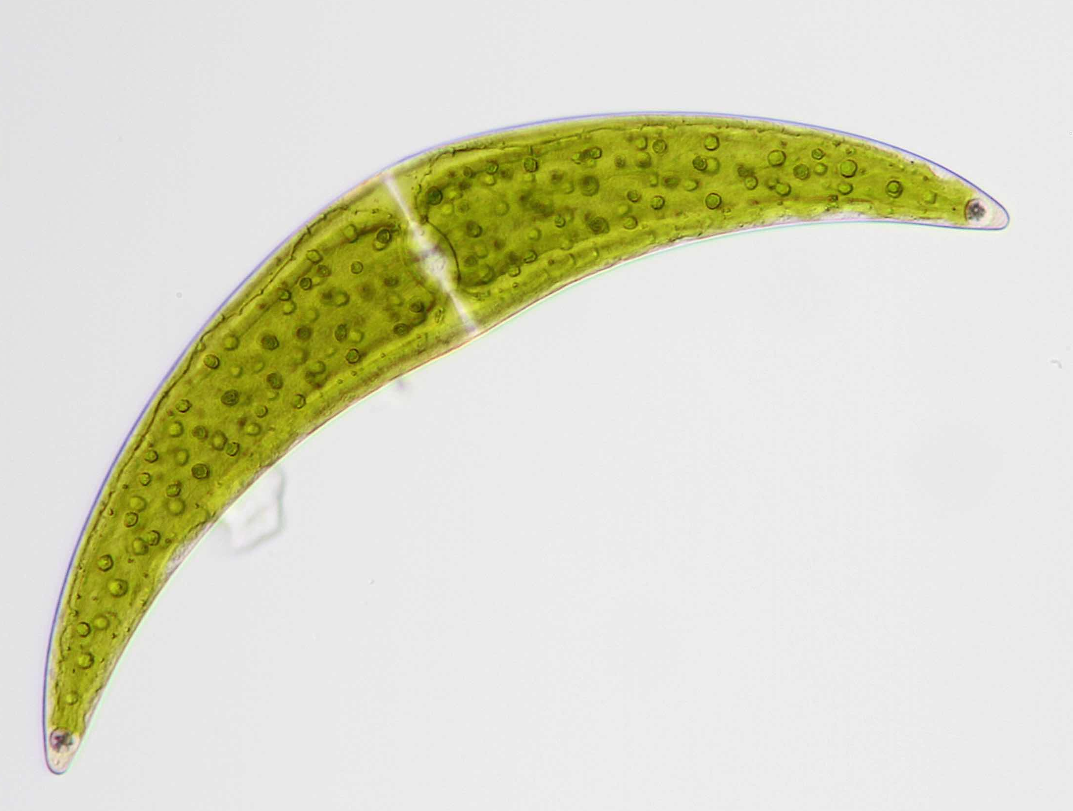Closterium submoniliferum - Desmid of the Month: November 2024