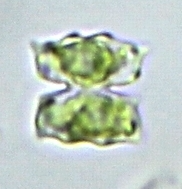 Eaurastrum minimum - Desmid of the Month: June 2024